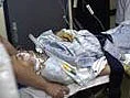 Full face transplant at Boston hospital | Khaleej Times