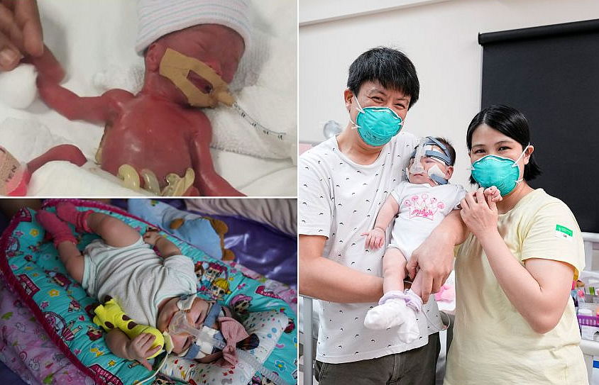 'World's smallest baby at birth' home after 13 months in hospital ...
