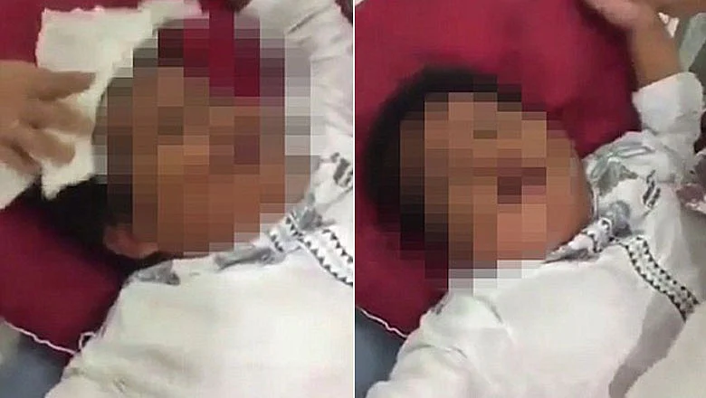 Boy's private part sliced in half with laser in botched circumcision ...