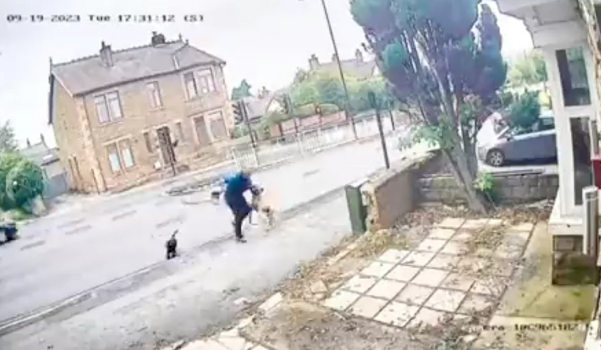 Watch: Dog attacks man, causes serious injuries in shocking video ...