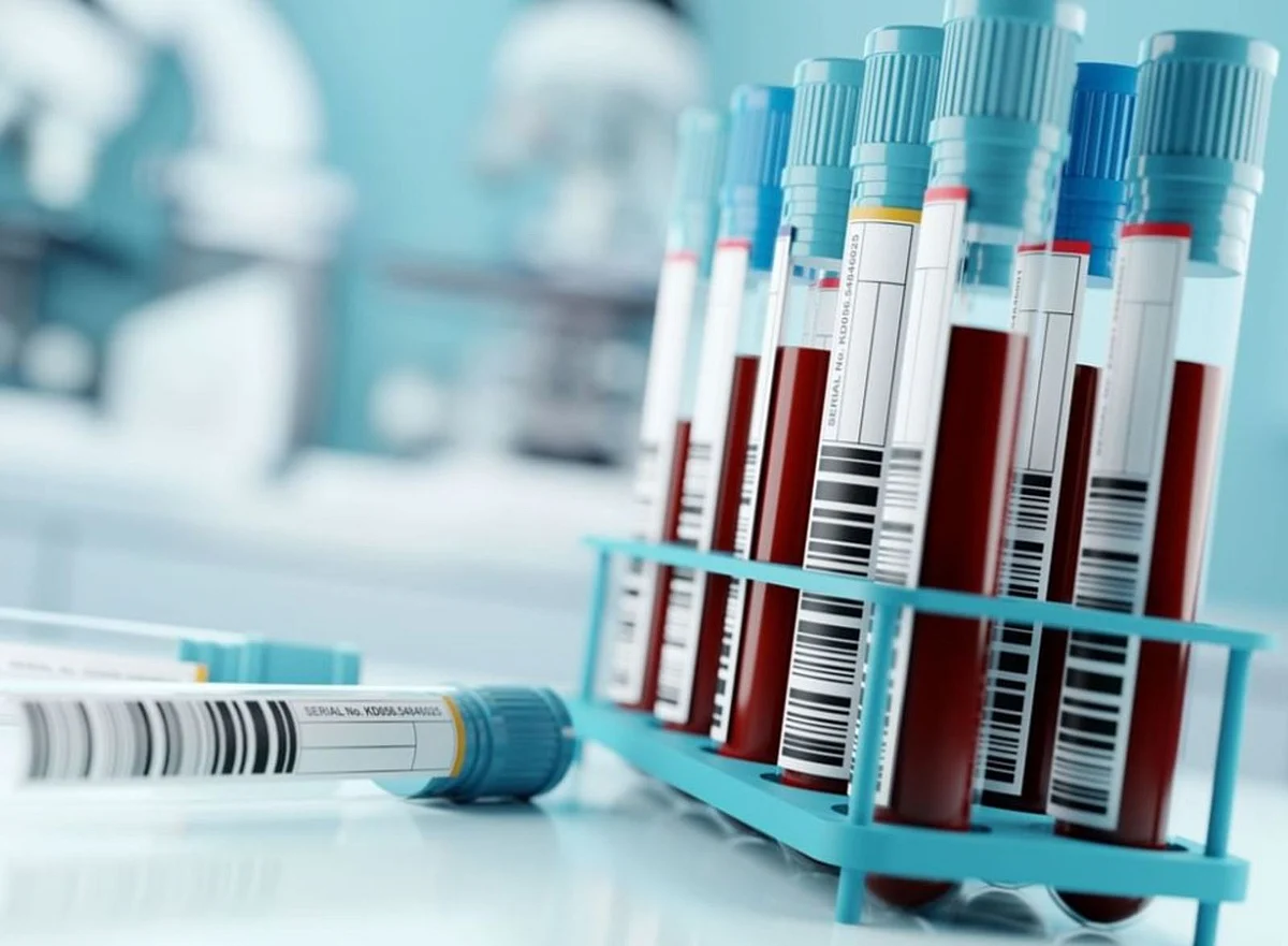Abu Dhabi introduces blood-based biopsy test for colorectal cancer ...
