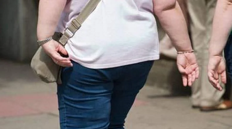 Man weighing 200kg dies after weight loss surgery | Khaleej Times