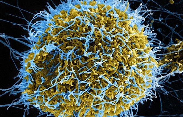 Japanese company develops world's most powerful microscope | Khaleej Times